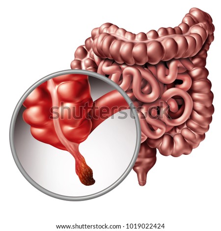 Appendix Stock Images, Royalty-Free Images & Vectors | Shutterstock