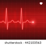 Heart-rate, EKG (ecg), Heart Beat Free Stock Photo - Public Domain Pictures
